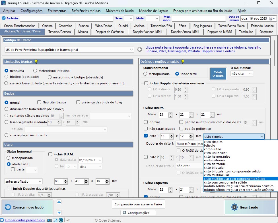 Download do Turing US 4.0 | Queo Sistemas Ltd